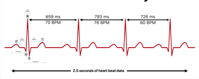 Heart Rate Variability – Everything You Need to Know as a Runner ...